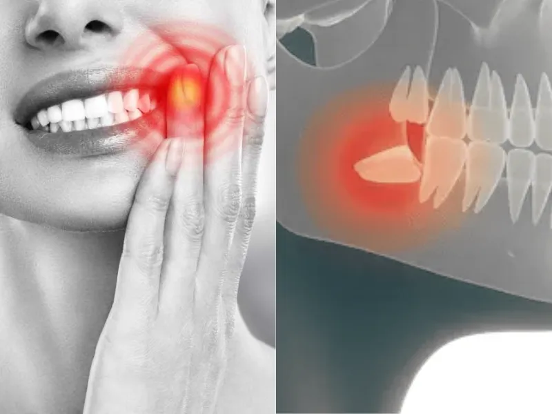 Dental stress & bruxism: Causes and prevention